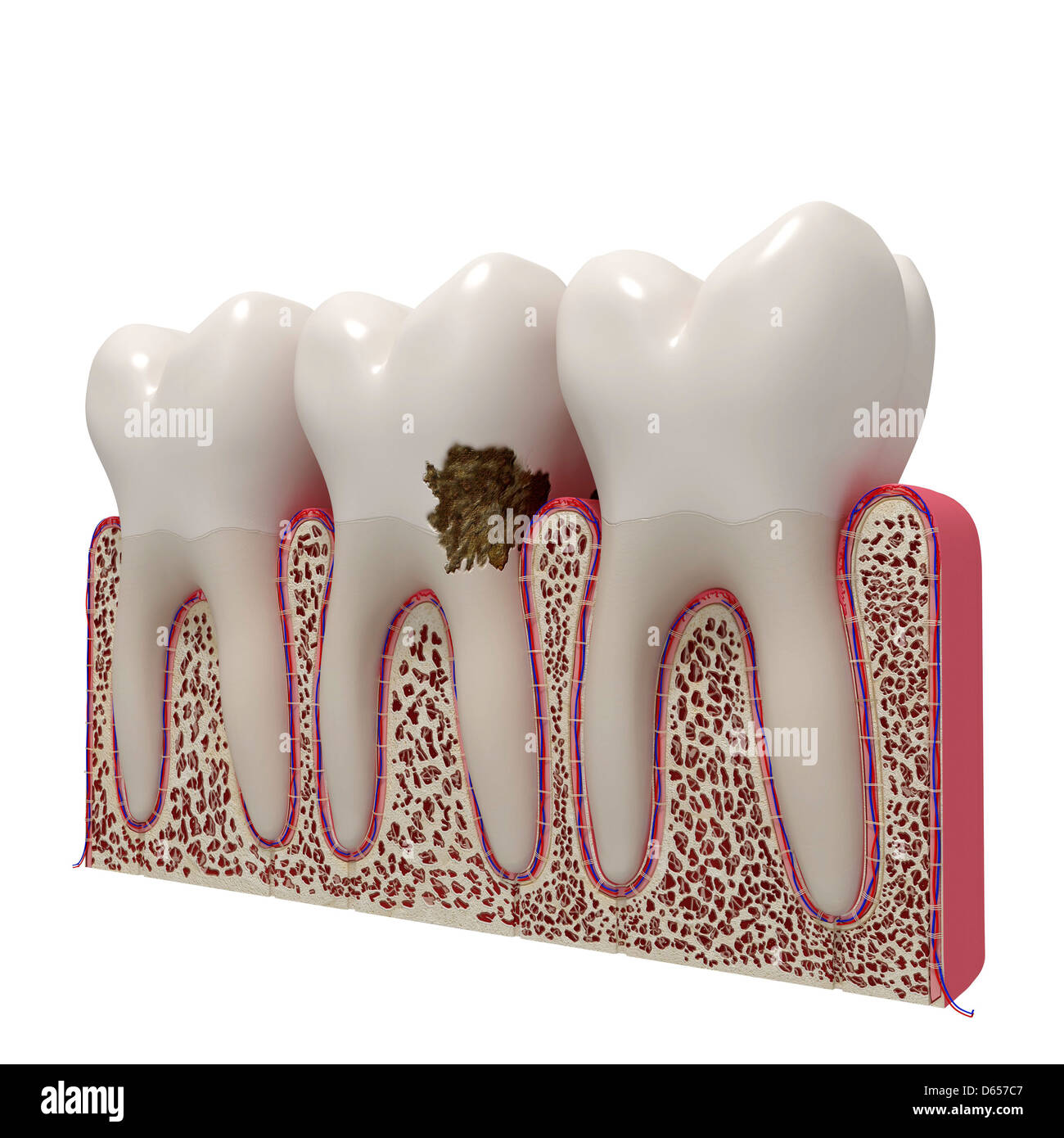 Root human teeth hi-res stock photography and images - Alamy