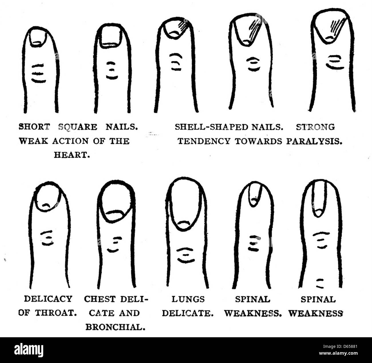This image, labeled 'Fig 15' from a palmistry guide, shows a detailed ...