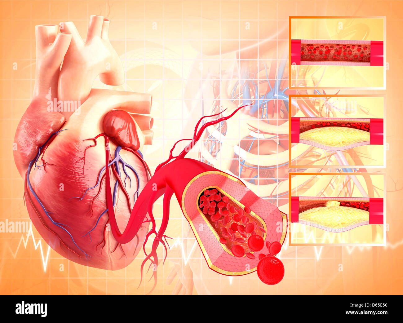 Blood Vessel Repair High Resolution Stock Photography and Images - Alamy