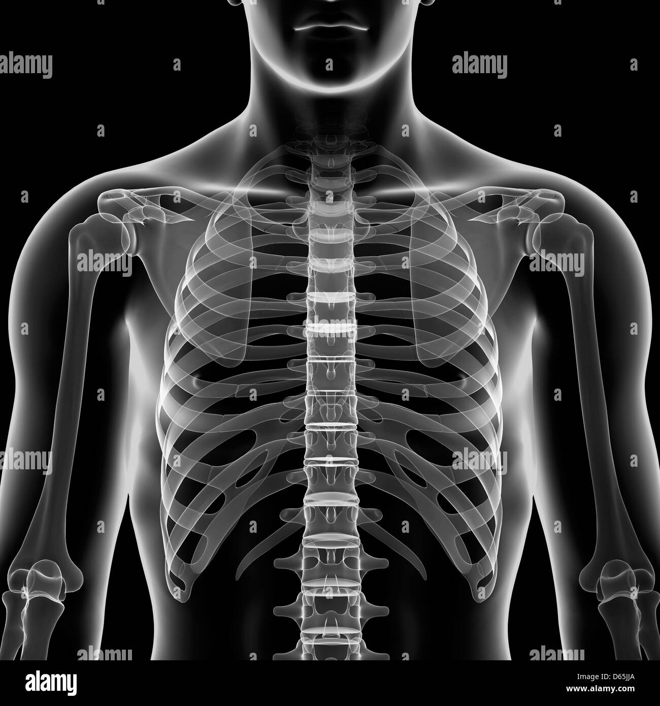Chest Radiograph Wikidata