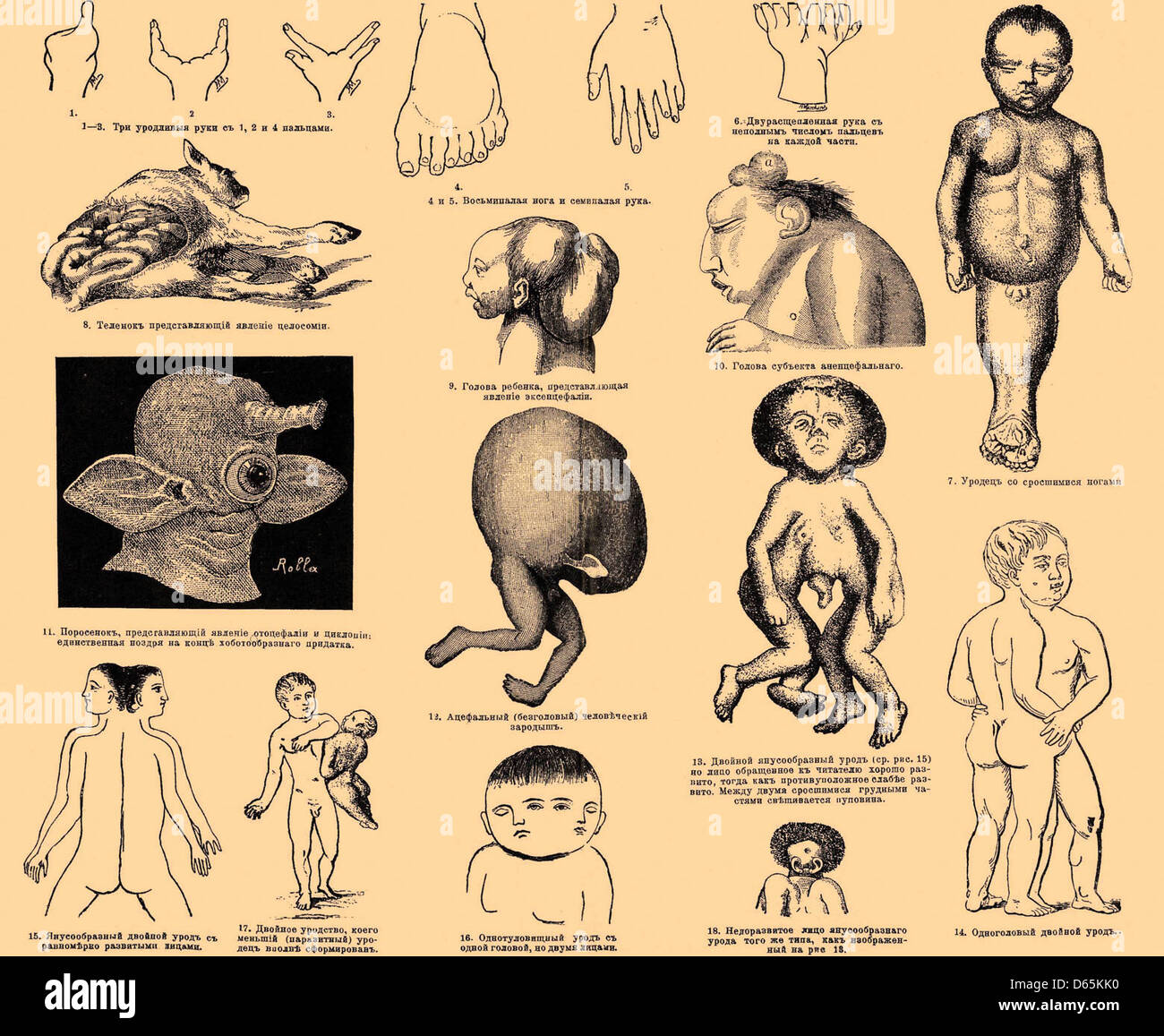 Physical Defects High Resolution Stock Photography and Images - Alamy