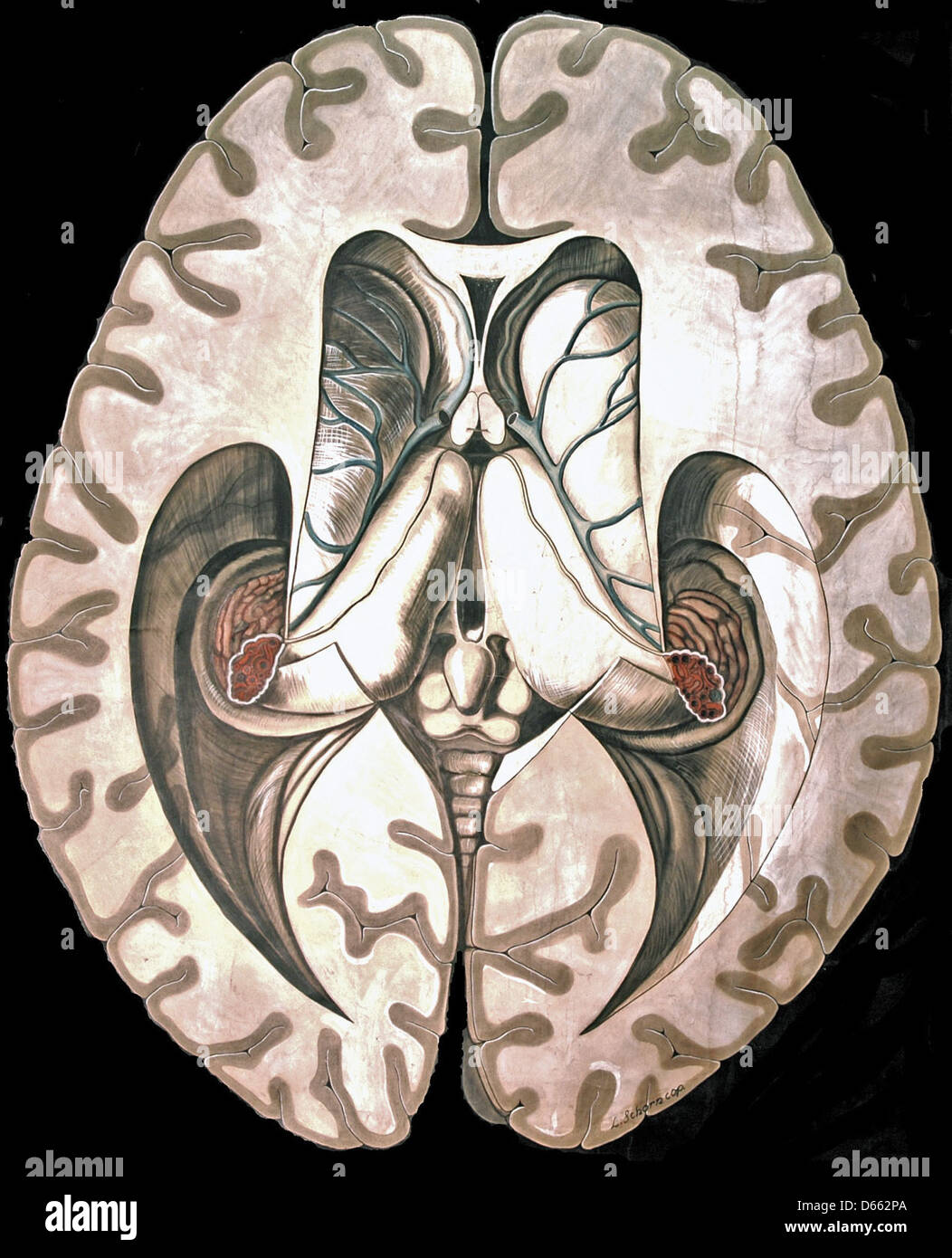 Ventricles anatomy hi-res stock photography and images - Alamy