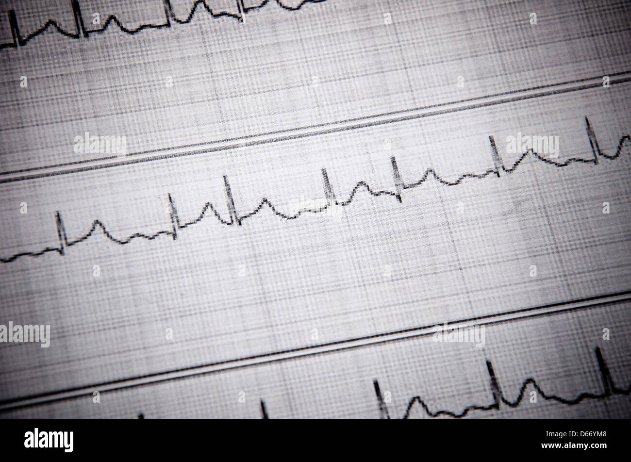 Ecg screen hi-res stock photography and images - Alamy