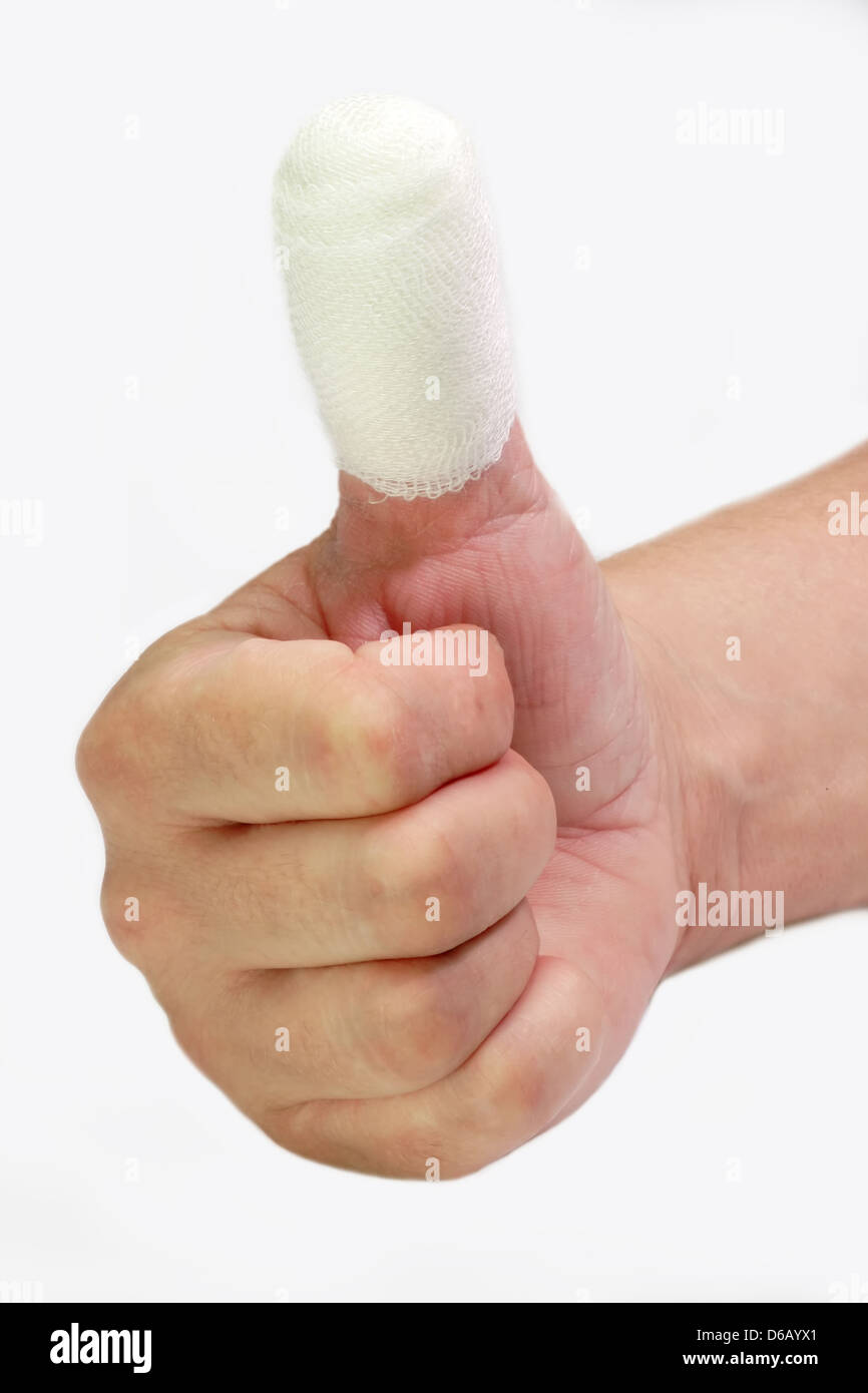 Thumb Injuries High Resolution Stock Photography and Images - Alamy
