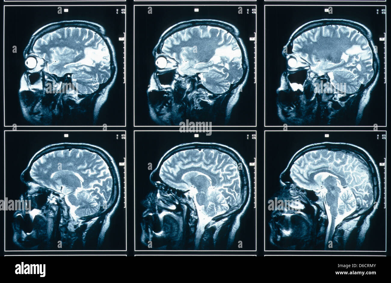 Human head cross section hi-res stock photography and images - Alamy