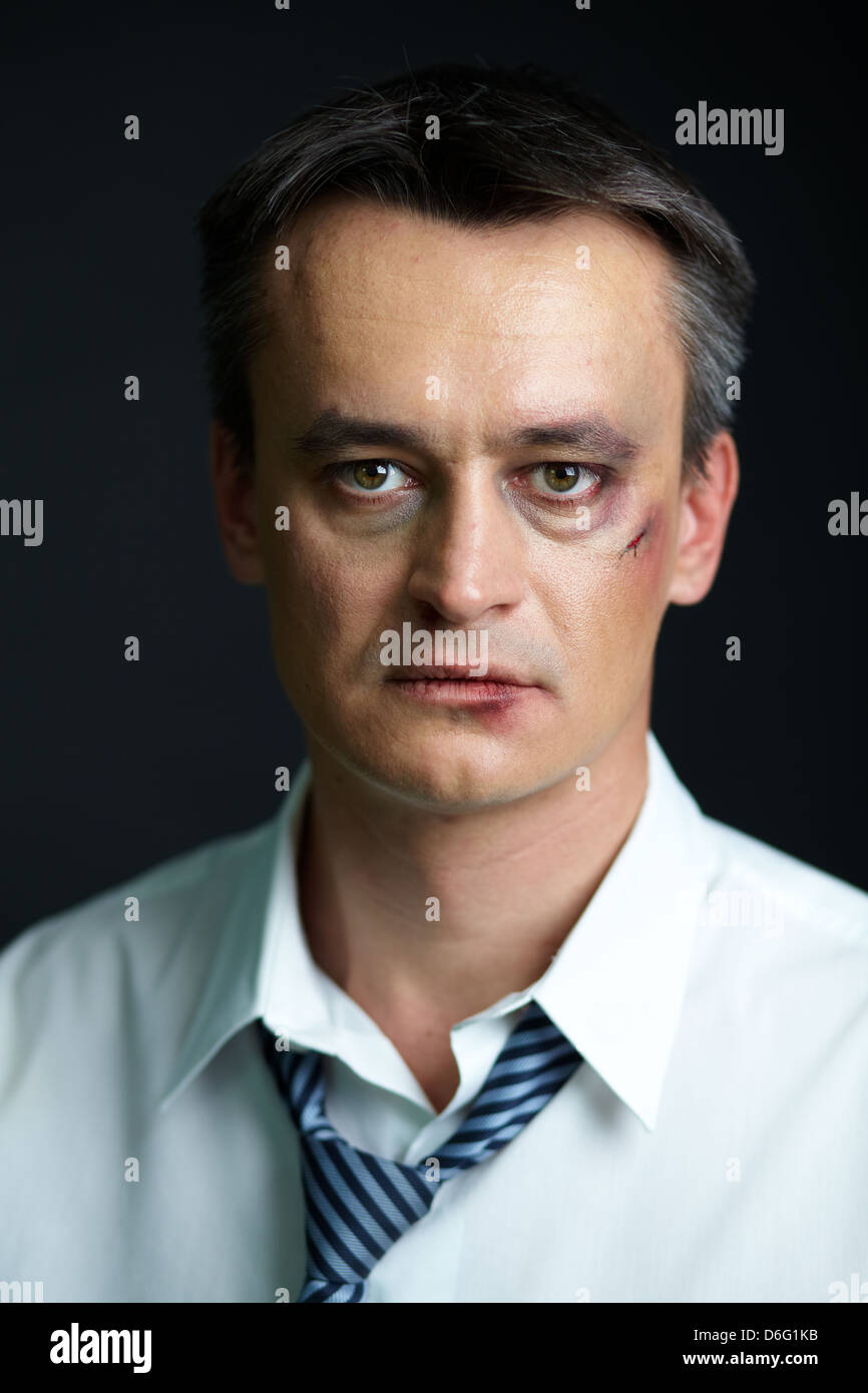 Portrait businessman bruise looking camera hi-res stock photography and ...