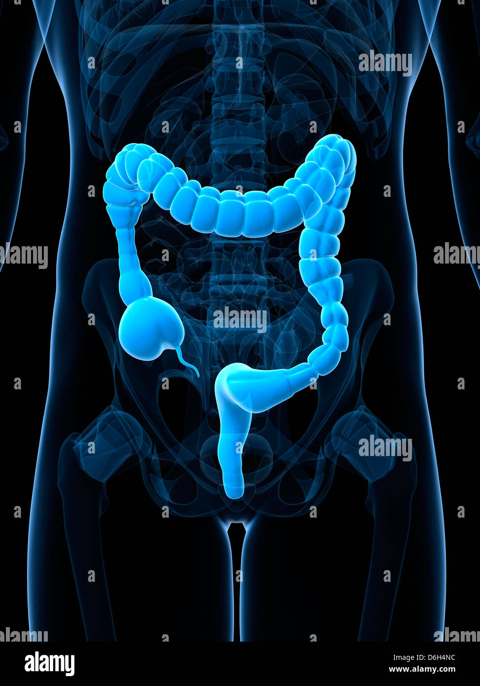 Colonic hi-res stock photography and images - Alamy