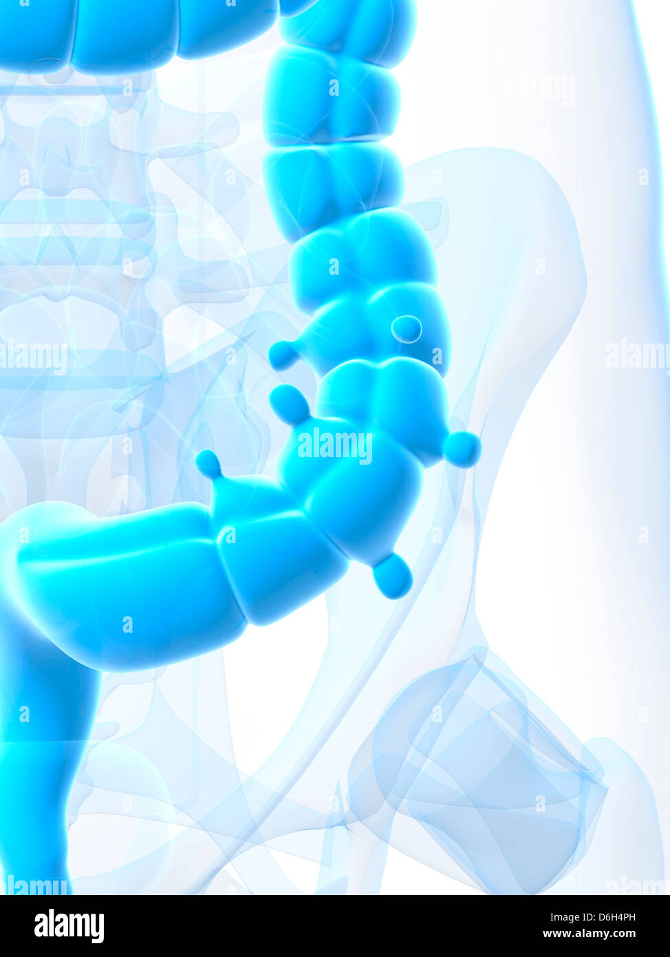 Colon diverticulosis hi-res stock photography and images - Alamy