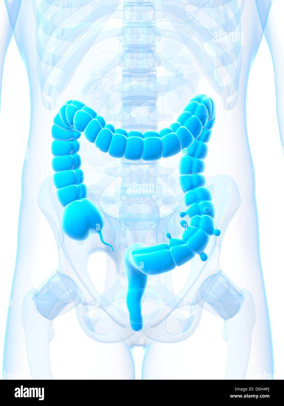 Colon diverticulosis hi-res stock photography and images - Alamy