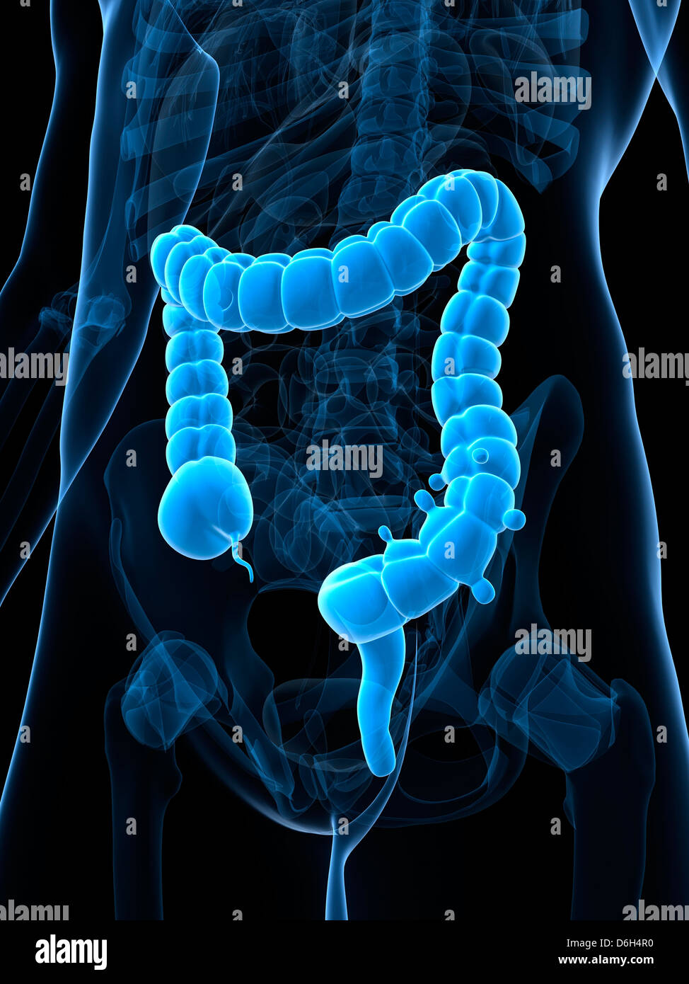 Diverticulosis of colon hi-res stock photography and images - Alamy