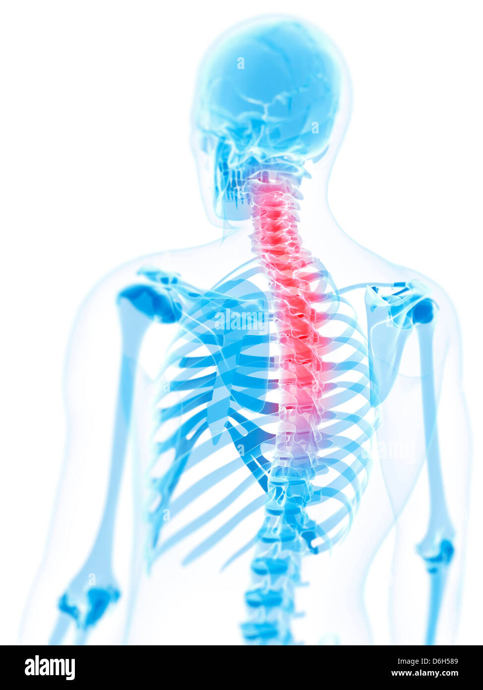 Back pain, conceptual artwork Stock Photo - Alamy