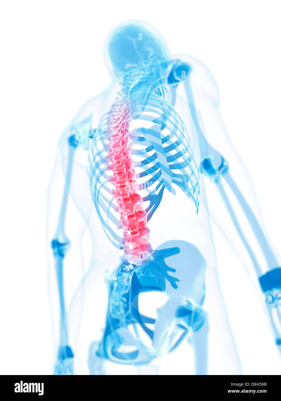 Back pain, conceptual artwork Stock Photo - Alamy