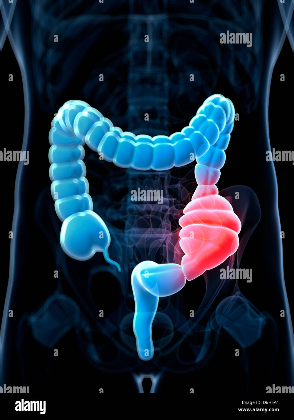 Constipated artwork hi-res stock photography and images - Alamy