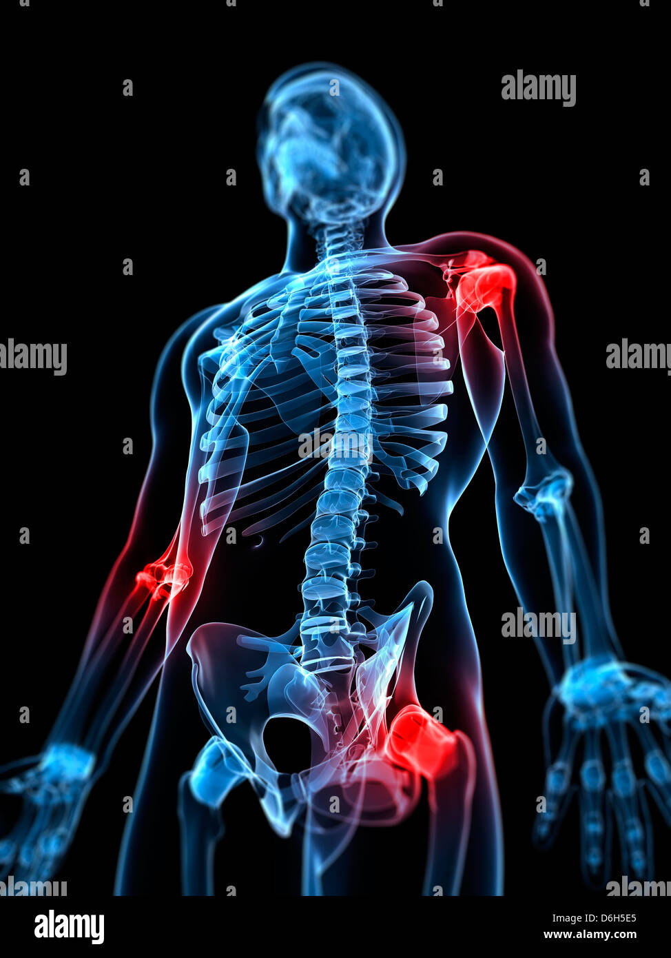 Joint pain, conceptual artwork Stock Photo - Alamy