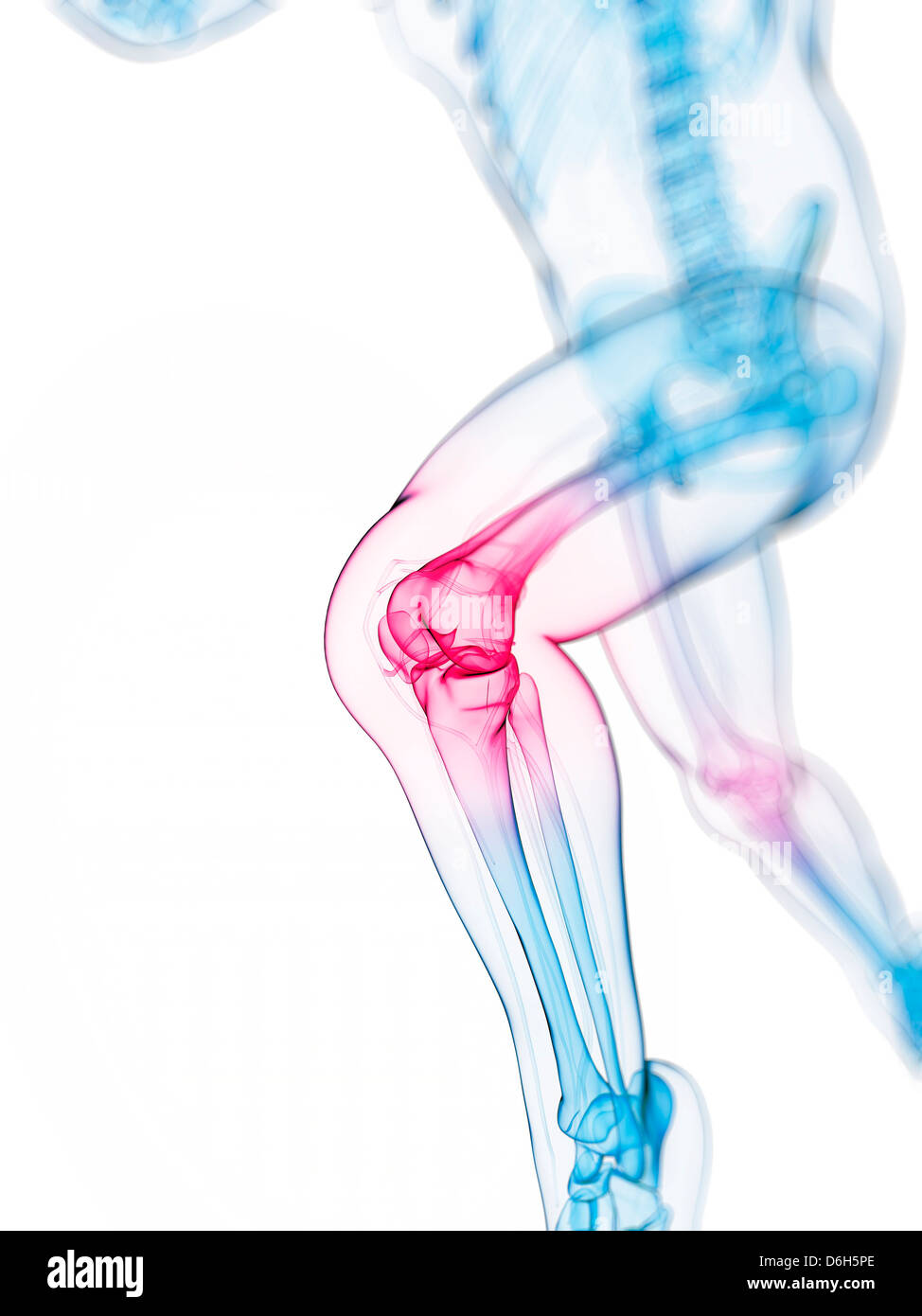 Knee pain, conceptual artwork Stock Photo - Alamy