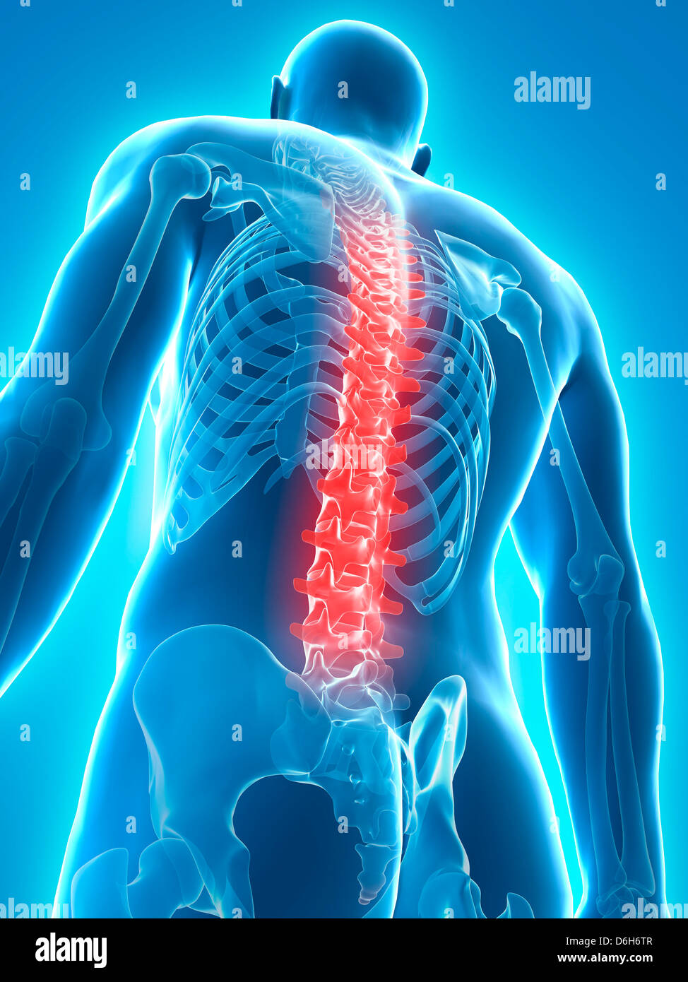 Back pain, conceptual artwork Stock Photo - Alamy