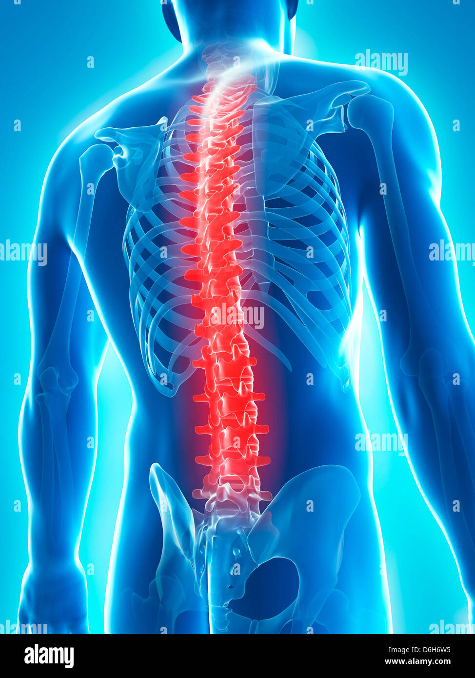 Back pain, conceptual artwork Stock Photo - Alamy