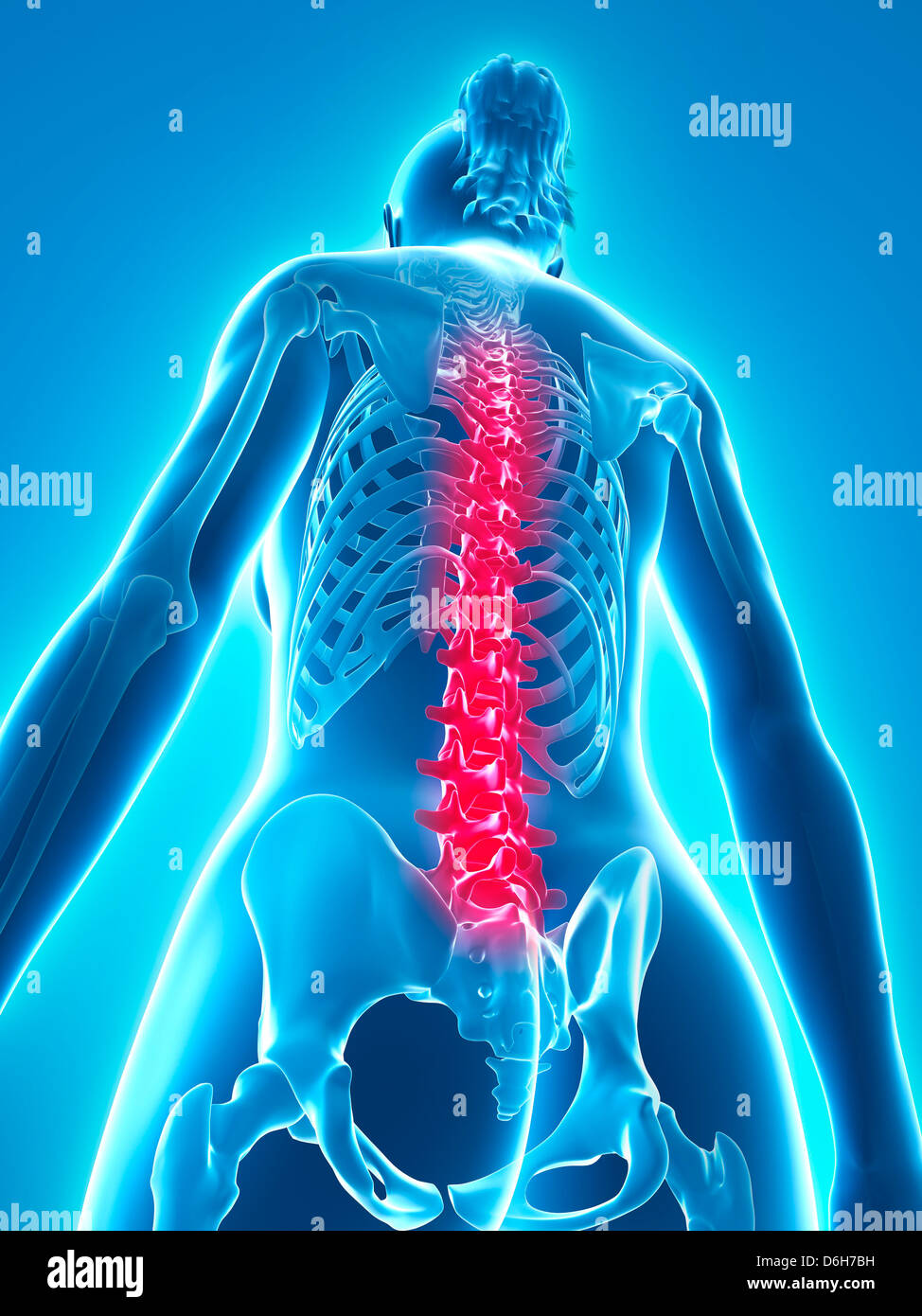 Back pain, conceptual artwork Stock Photo - Alamy