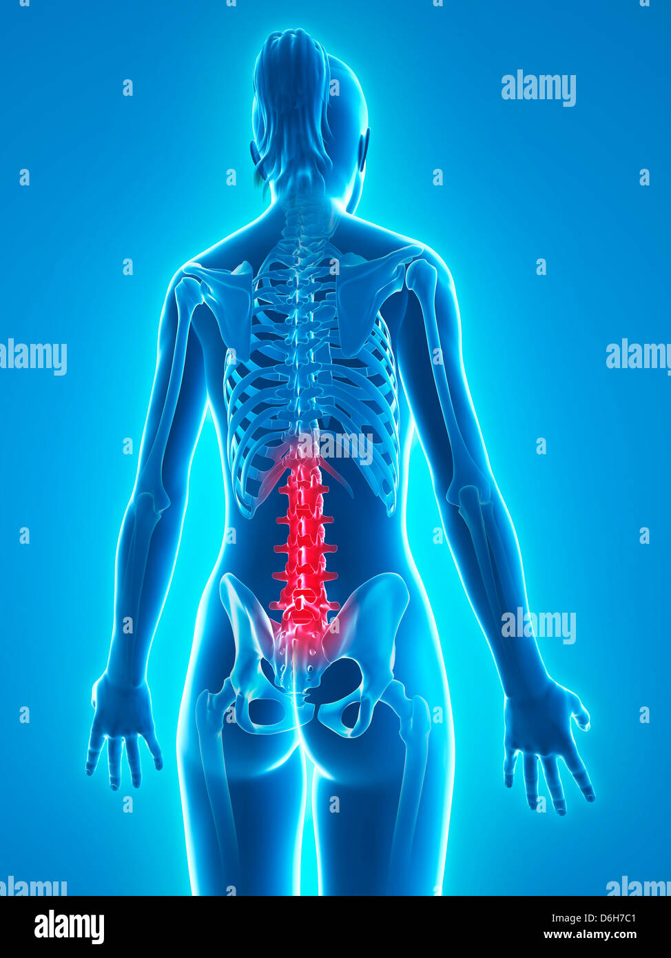 Back pain conceptual artwork hi-res stock photography and images - Alamy