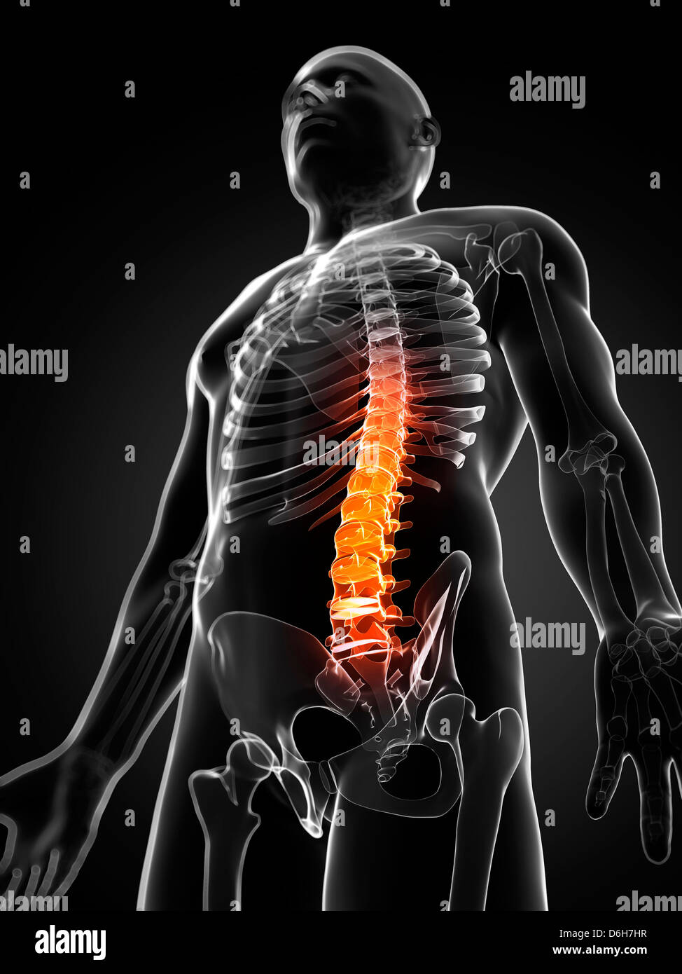 Back pain, conceptual artwork Stock Photo - Alamy