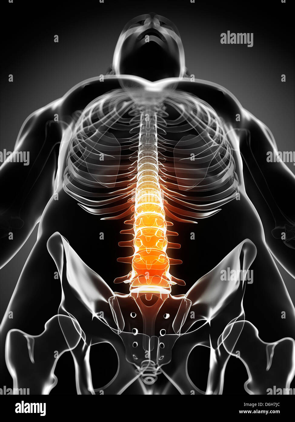 Back pain, conceptual artwork Stock Photo - Alamy