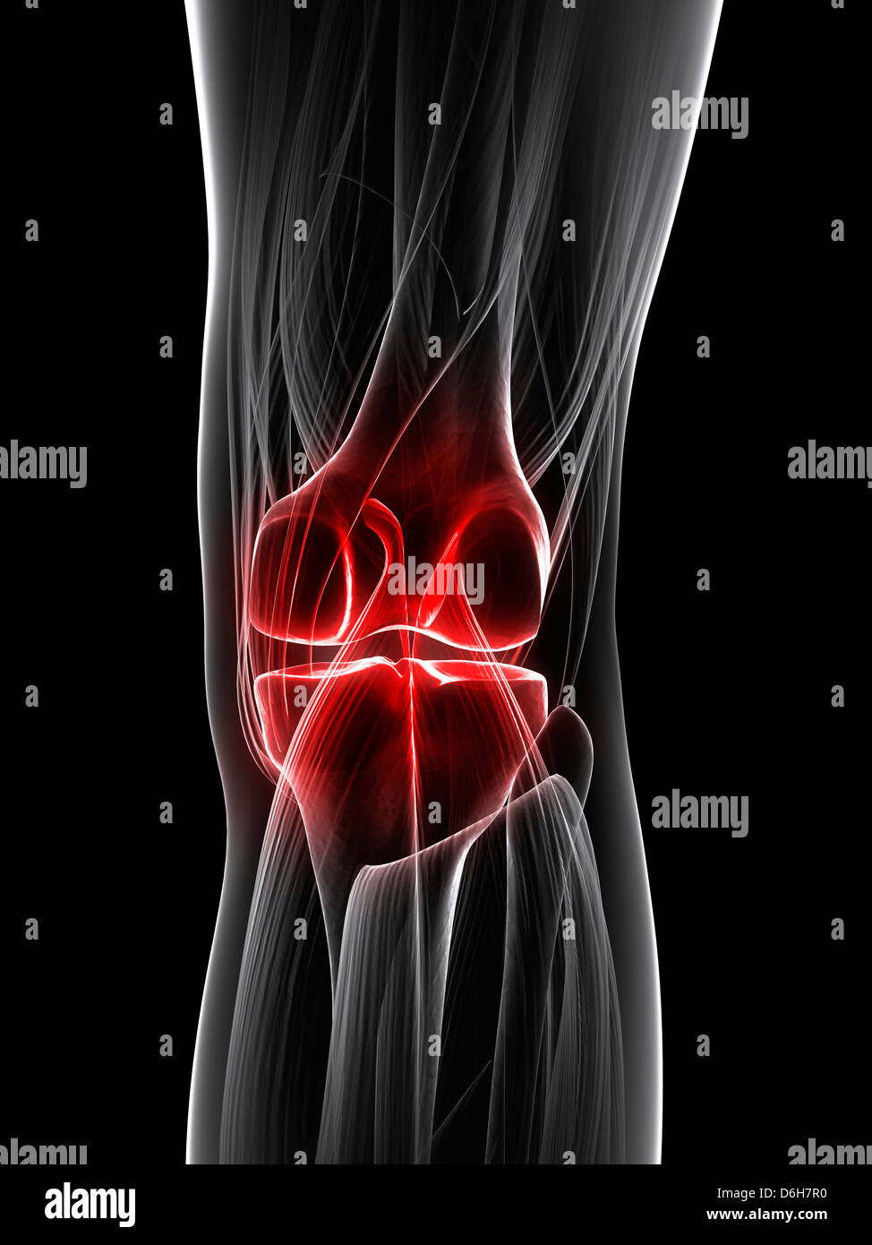 Knee pain, conceptual artwork Stock Photo - Alamy