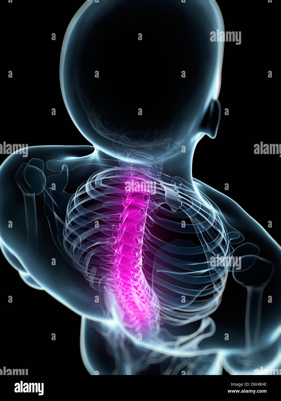 Back pain, conceptual artwork Stock Photo - Alamy