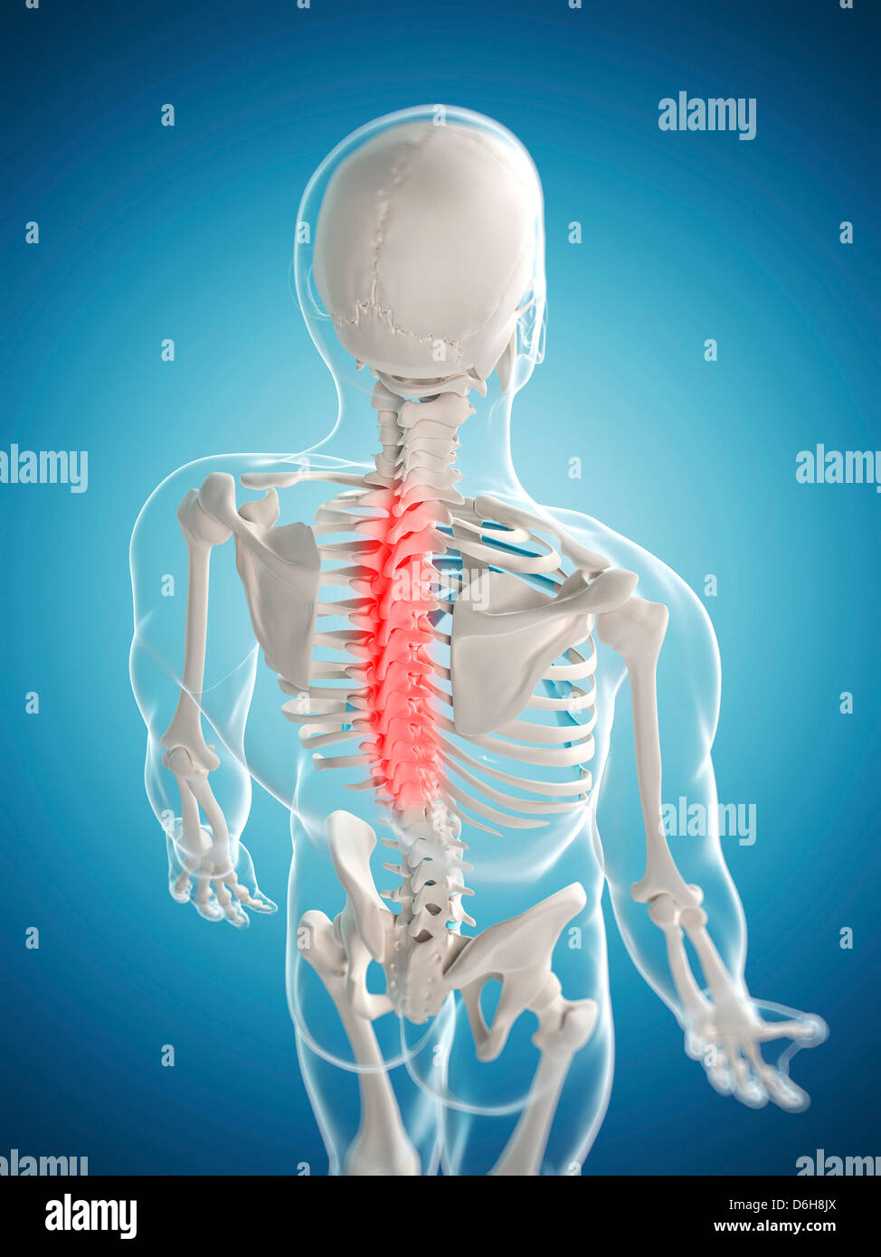 Back pain, conceptual artwork Stock Photo - Alamy