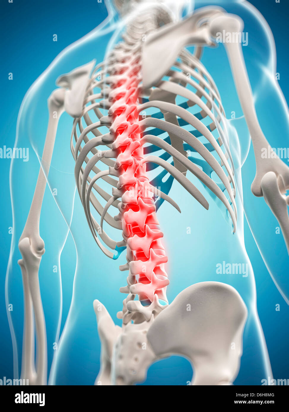 Back pain, conceptual artwork Stock Photo - Alamy
