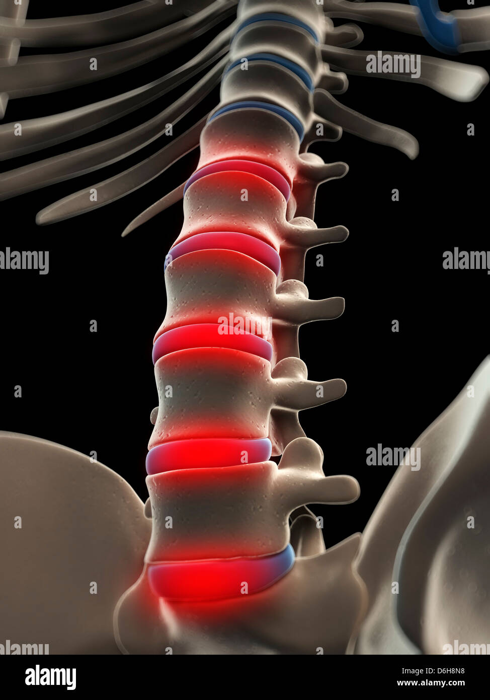 Back pain, conceptual artwork Stock Photo - Alamy