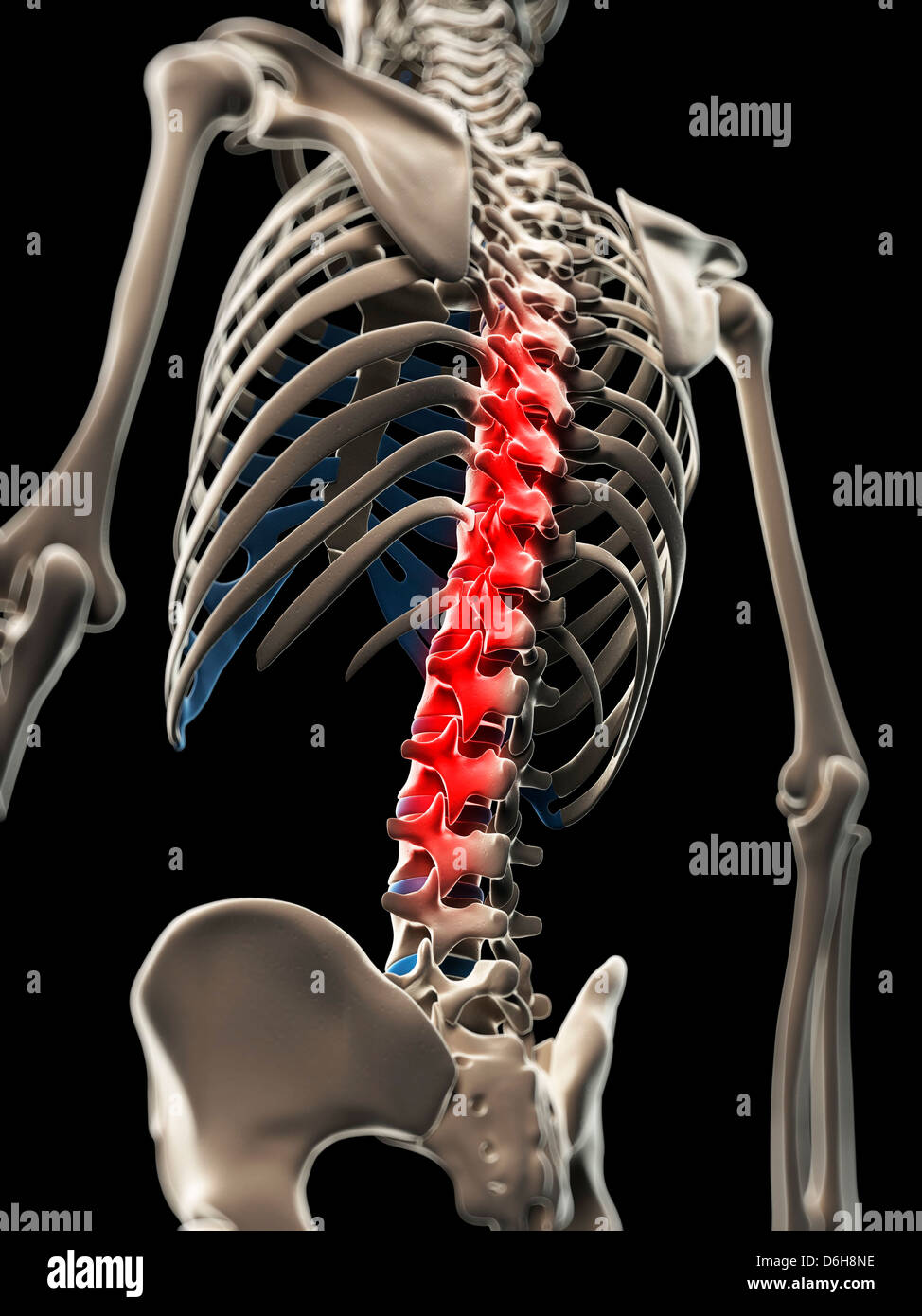 Back pain, conceptual artwork Stock Photo - Alamy