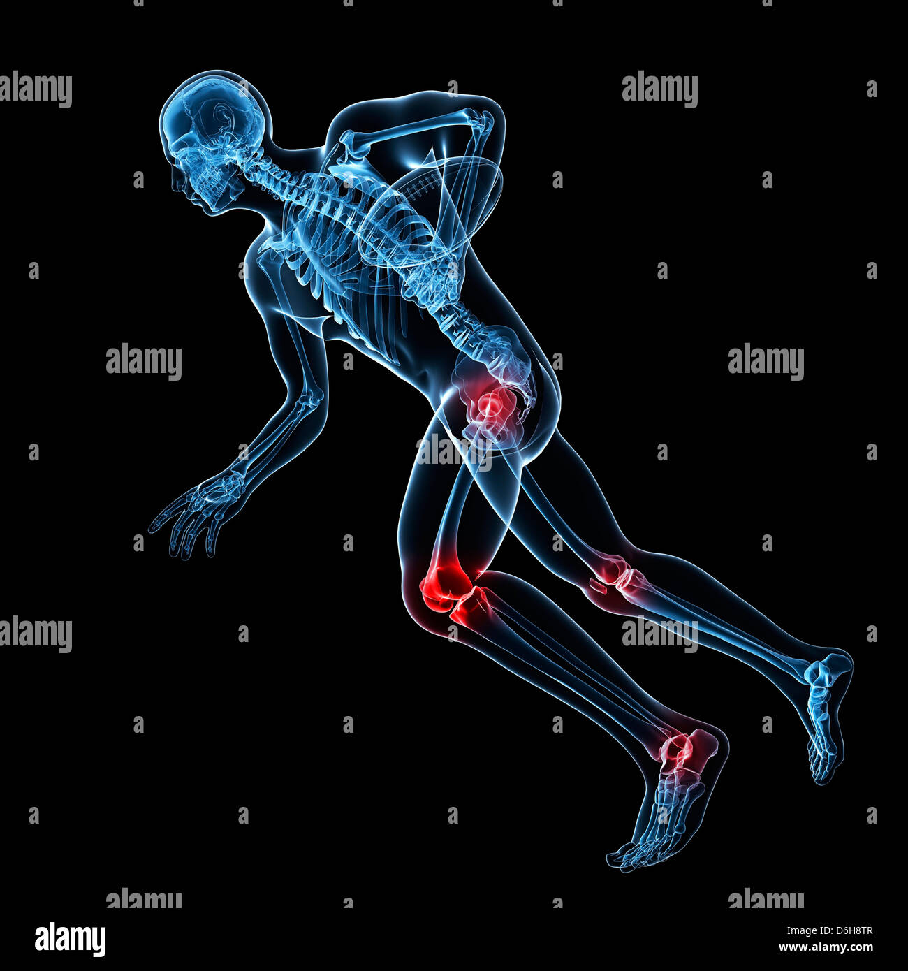 Sports injuries, conceptual artwork Stock Photo - Alamy