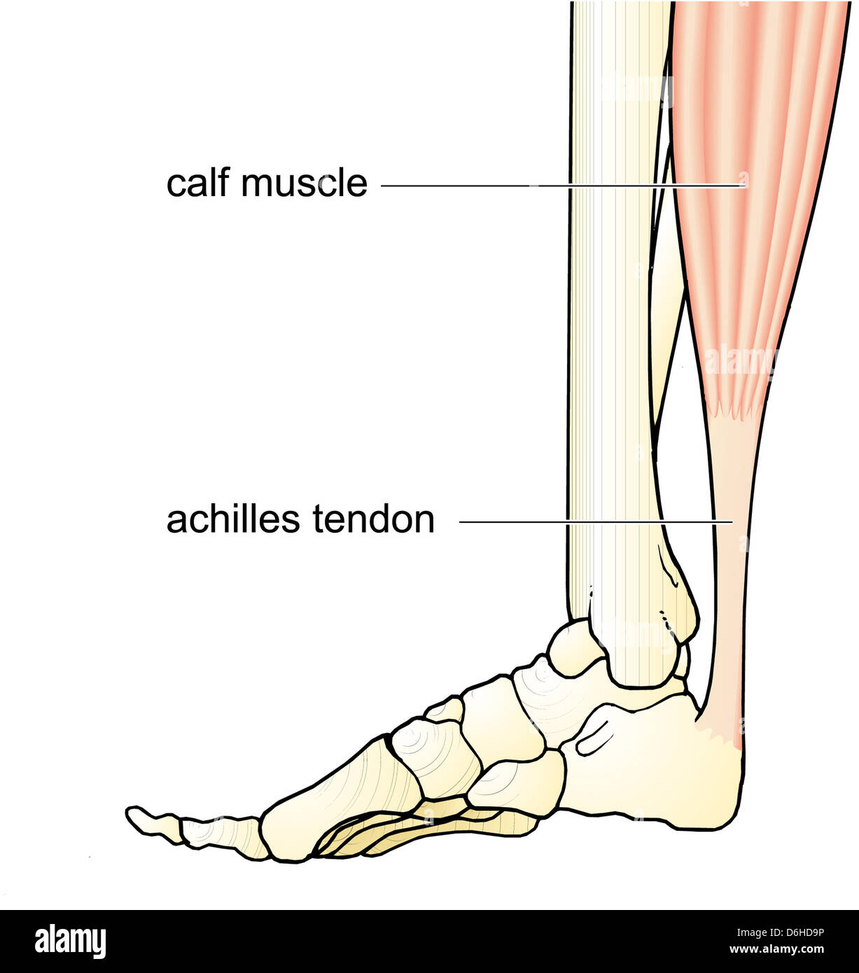 Achilles tendon rupture hi-res stock photography and images - Alamy