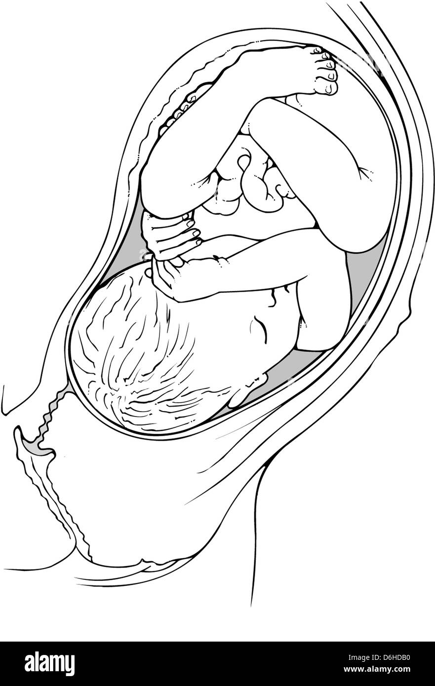 Giving birth Black and White Stock Photos & Images - Alamy