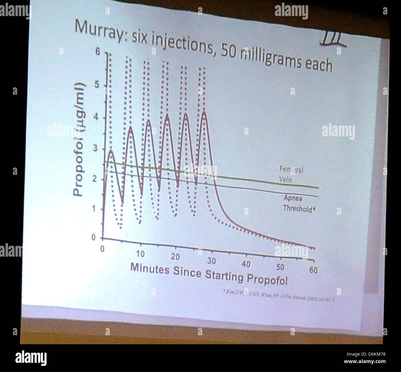 A chart showing propofol injections is projected onto a screen during ...