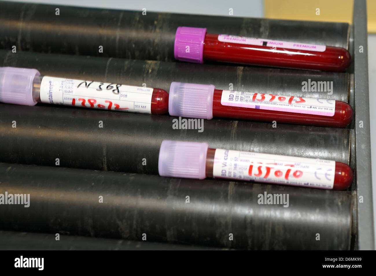 Blood diagnostics hi-res stock photography and images - Alamy