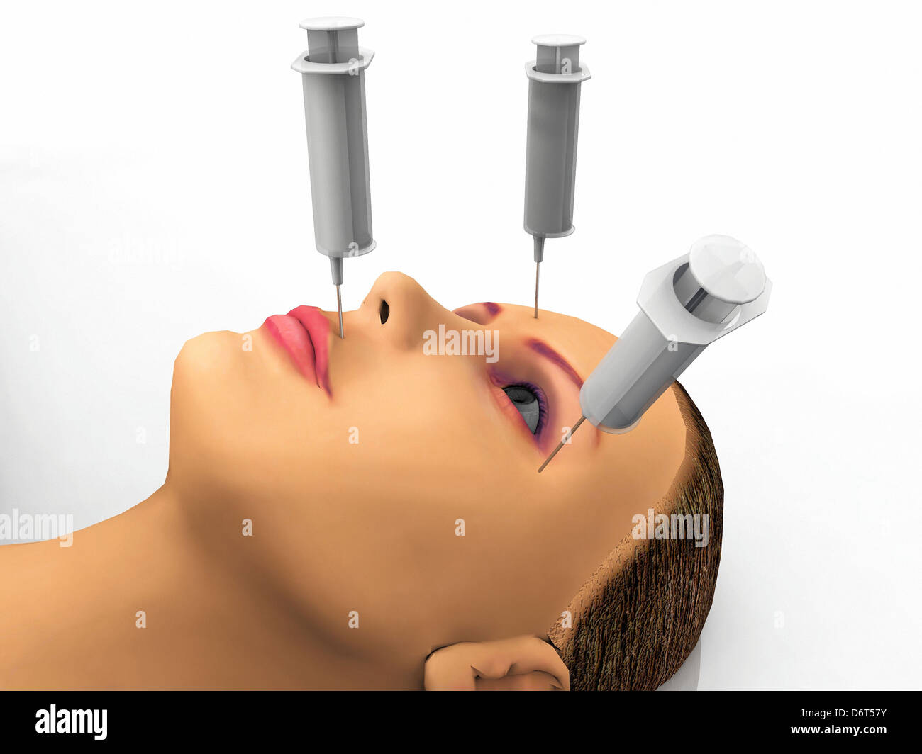 Women and many botox syringes Stock Photo - Alamy