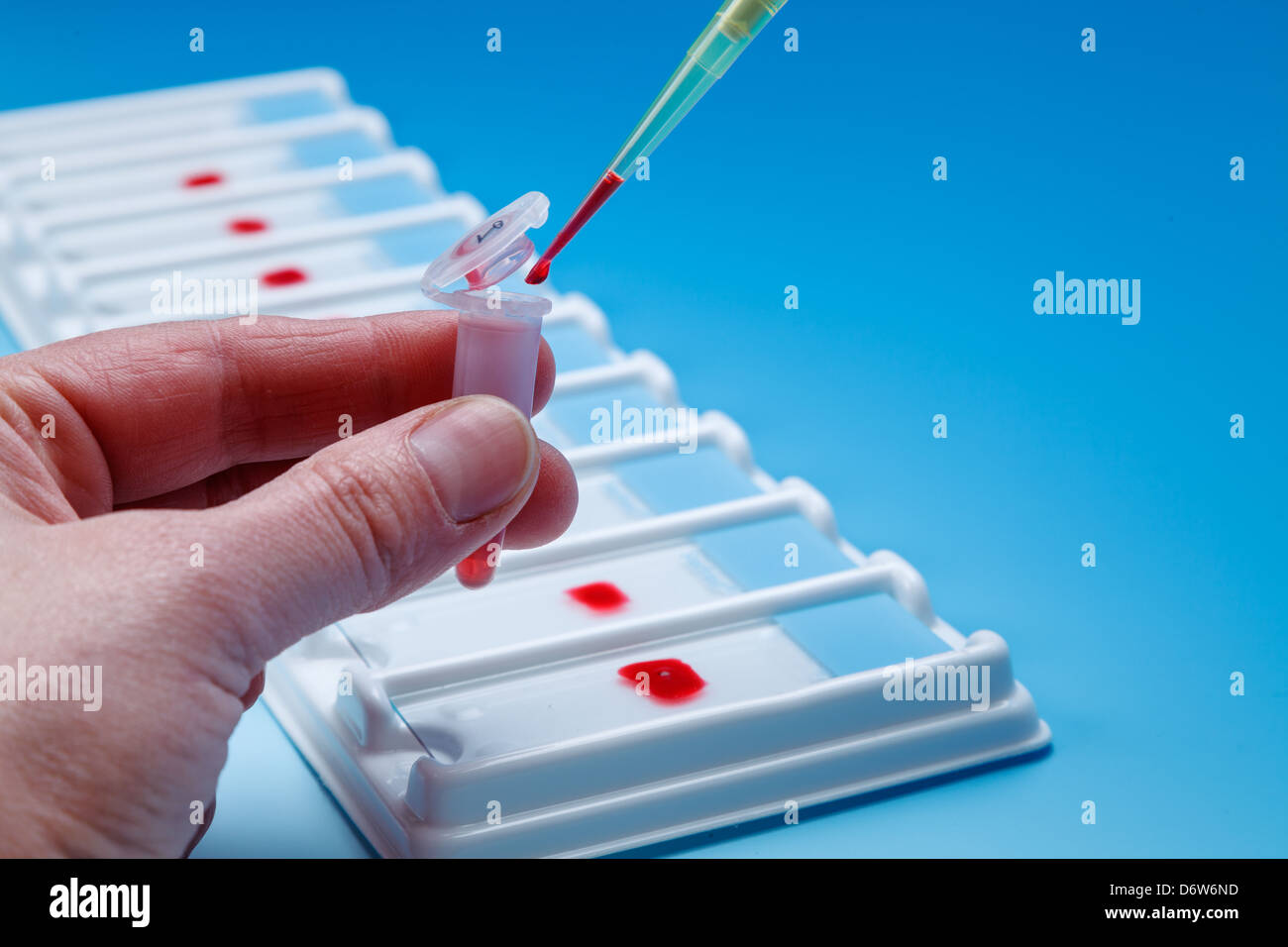 Microscope slide preparation hi-res stock photography and images - Alamy