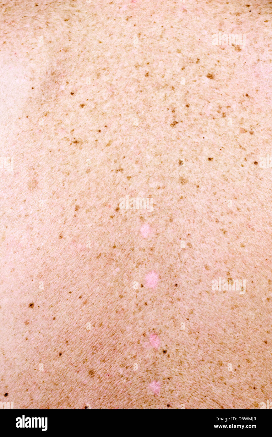 Mole_skin hi-res stock photography and images - Alamy