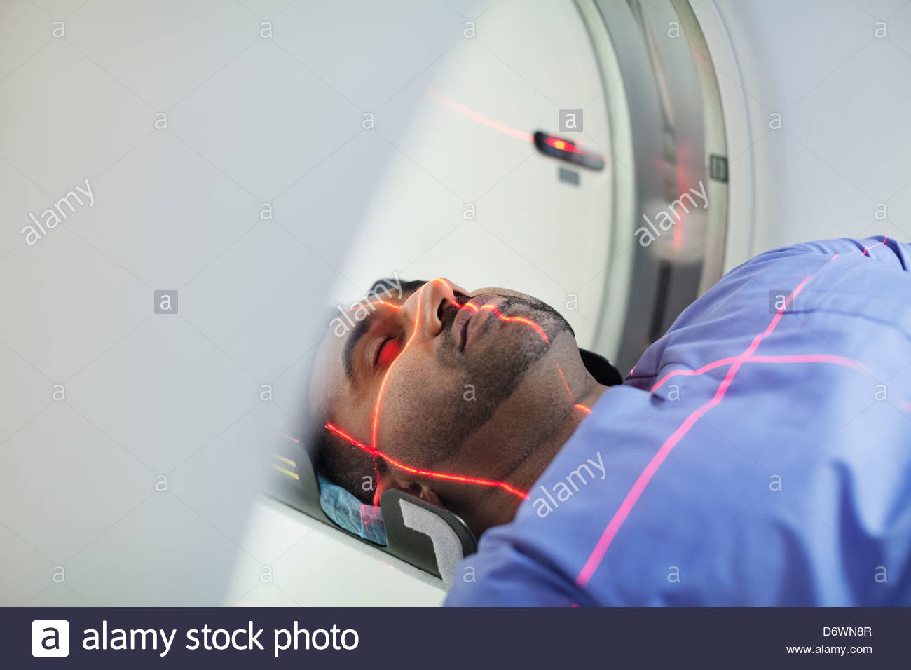 Mri Scan Eyes High Resolution Stock Photography and Images - Alamy