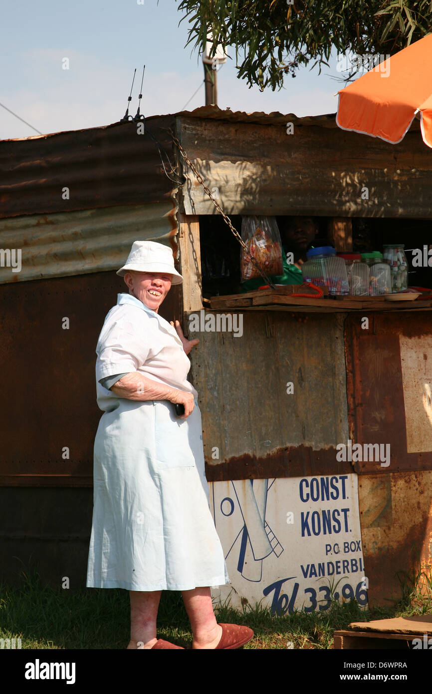 An African albino woman stands outside a tin shack selling sweet Stock ...