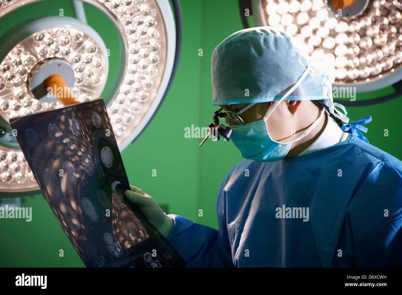 a surgeon wearing a medical loop glasses holding x ray image Stock ...