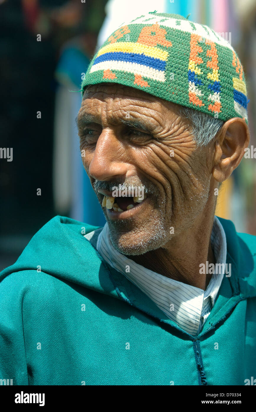 Models With Bad Teeth