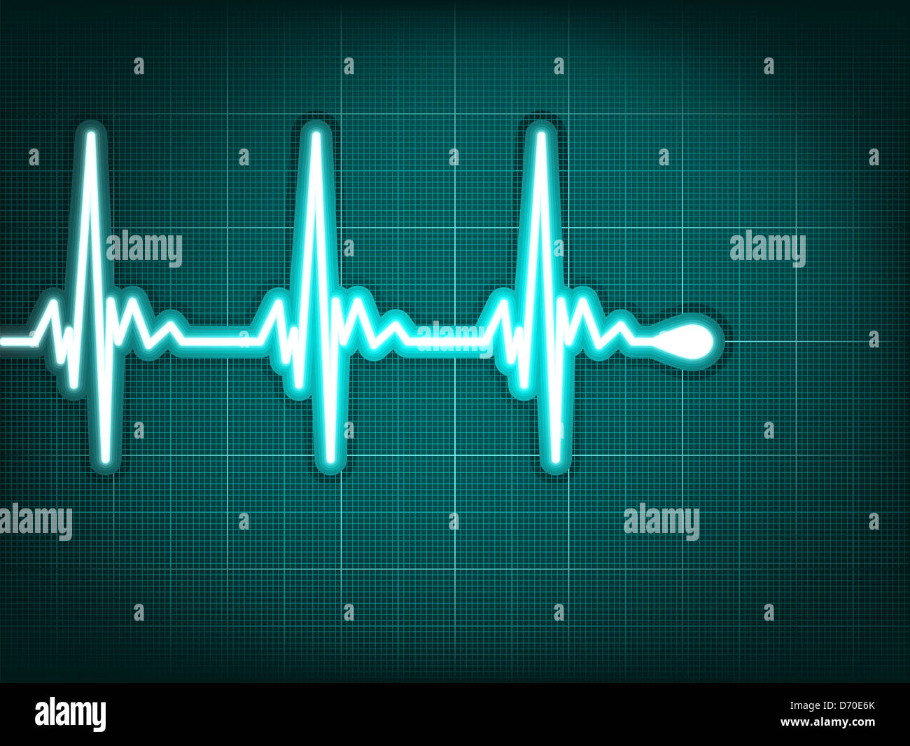 Electrocardiogram track of human heart Stock Photo - Alamy