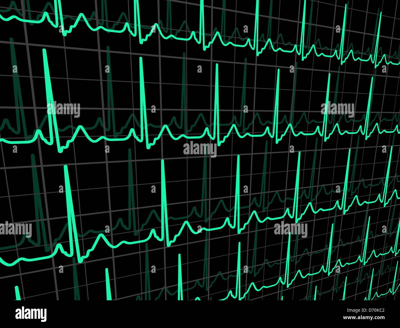 ECG tracing monitor Stock Photo - Alamy