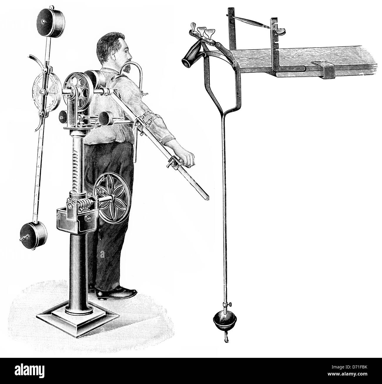 Physiotherapy on a pendulum apparatus by Krukenberg, therapeutic ...