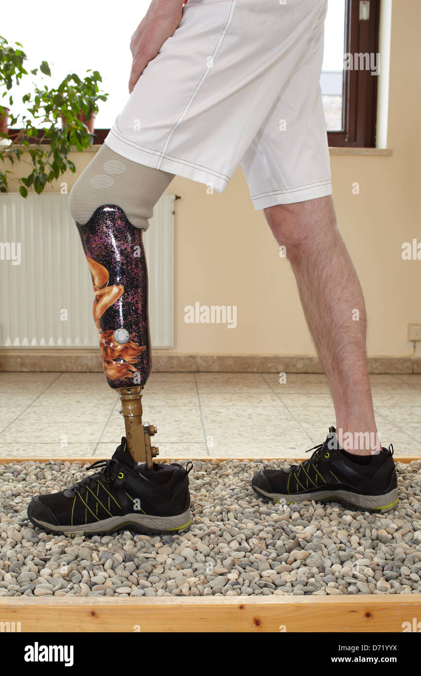 Male prosthesis wearer in training hi-res stock photography and images ...