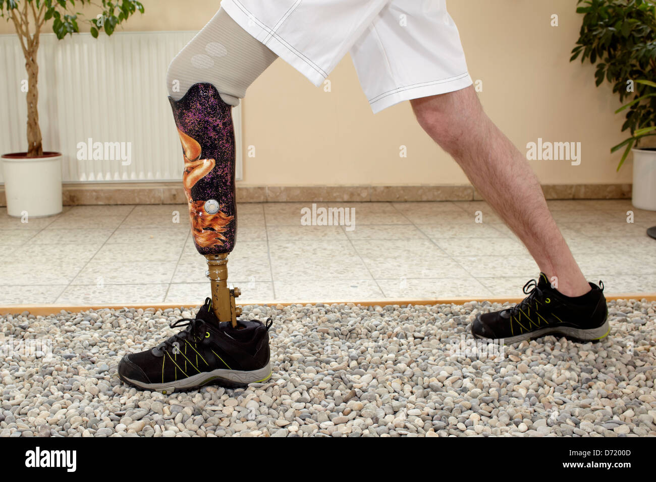 A male prosthesis wearer in a training situation Stock Photo - Alamy
