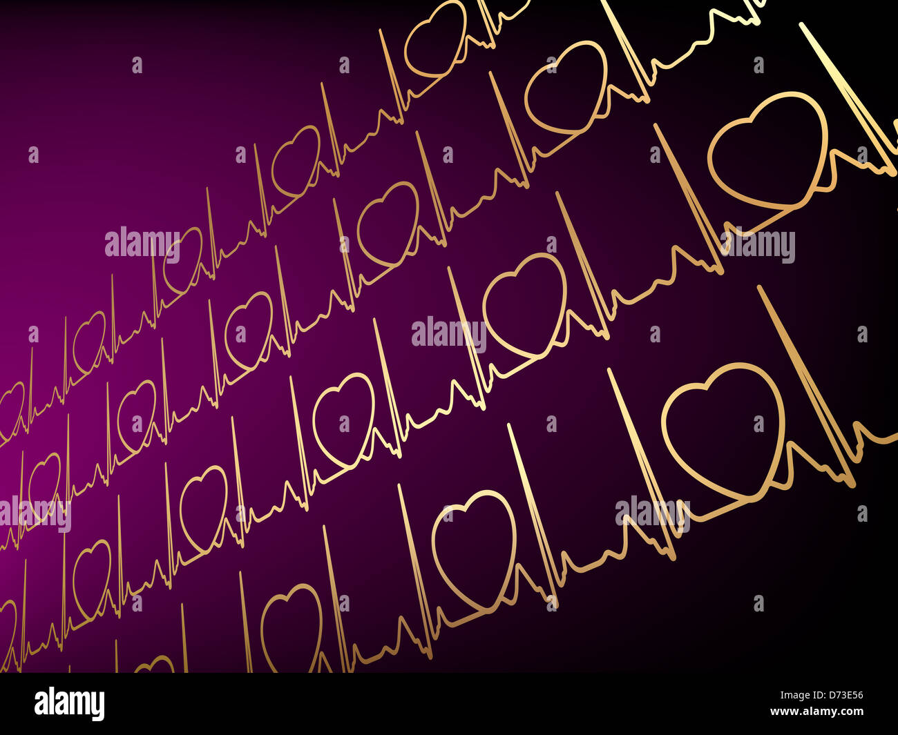 ECG tracing monitor Stock Photo - Alamy