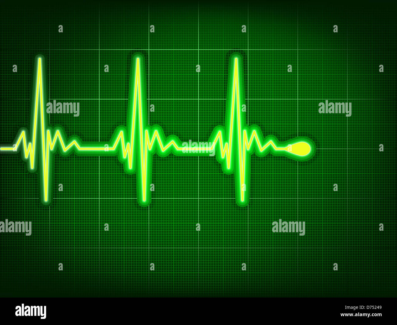 Heart cardiogram with shadow on it deep green Stock Photo - Alamy
